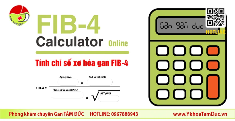 Tính chỉ số xơ hóa gan FIB-4 tại nhà (Fibrosis-4 Calculator)